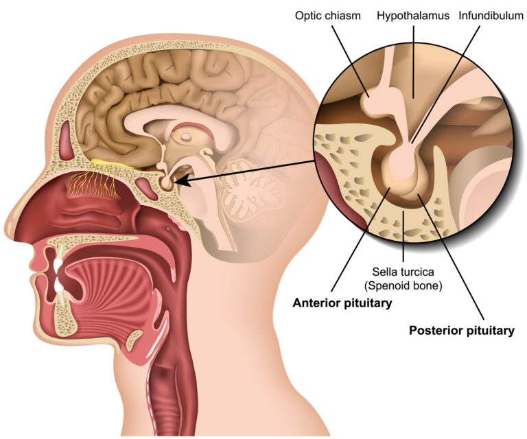 Pituitary Gland Disorders Treatment In Singapore Symptoms Causes 8930